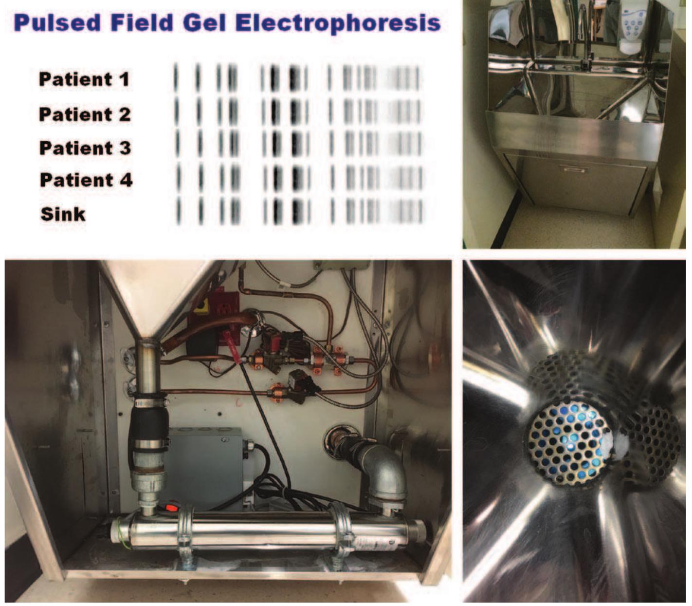 Pulsed field gel electrophoresis of pseudomonas aeruginosa