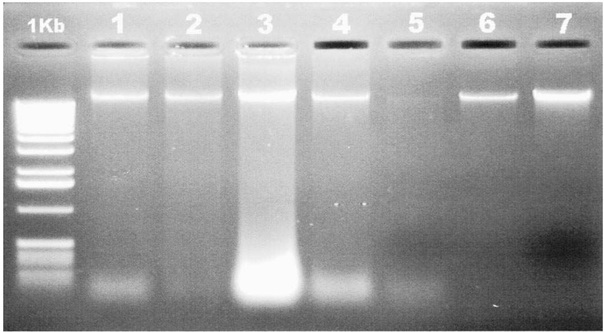 Electrophoresis of avian dna extracted from feathers. lane