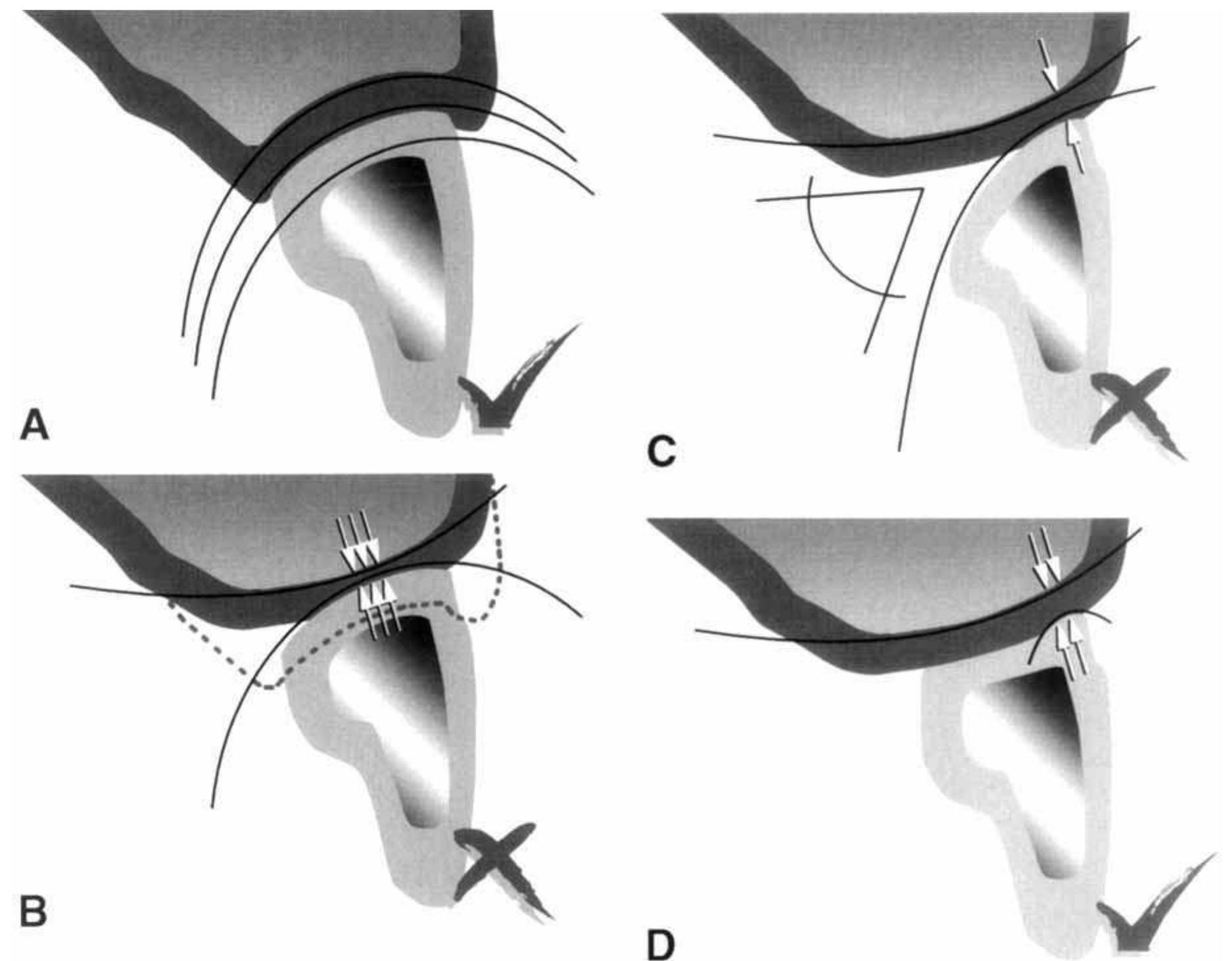Figure 12 - from TOPICS OF INTEREST The Esthetic Width in