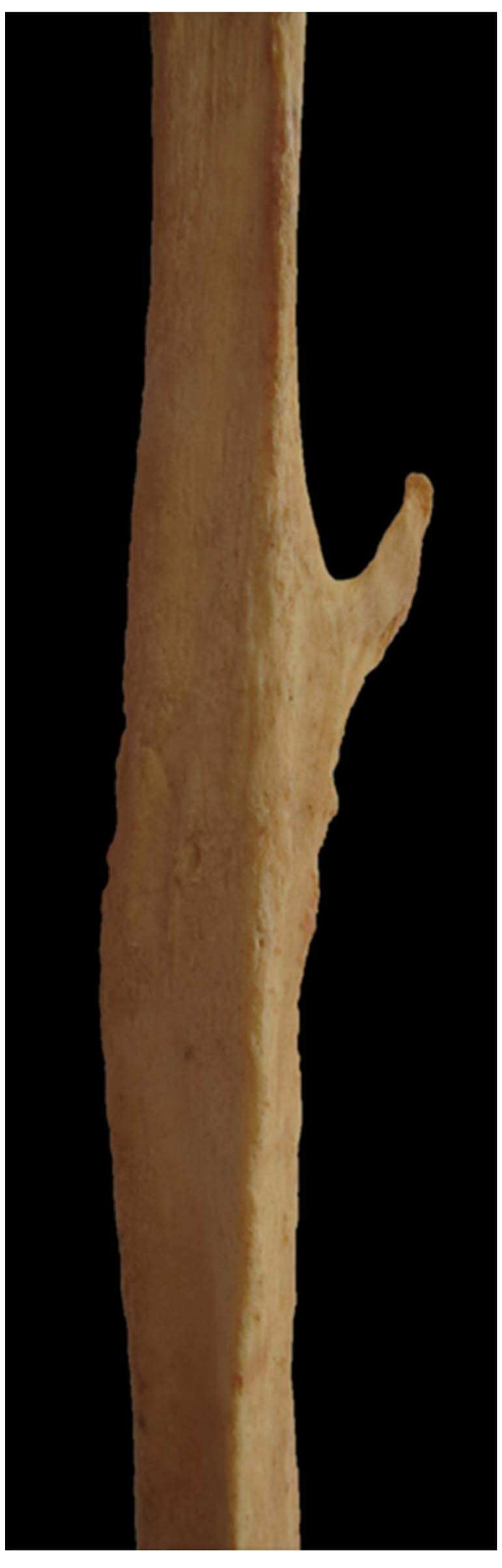 Anterior view of the proximal shaft of the right fibula,