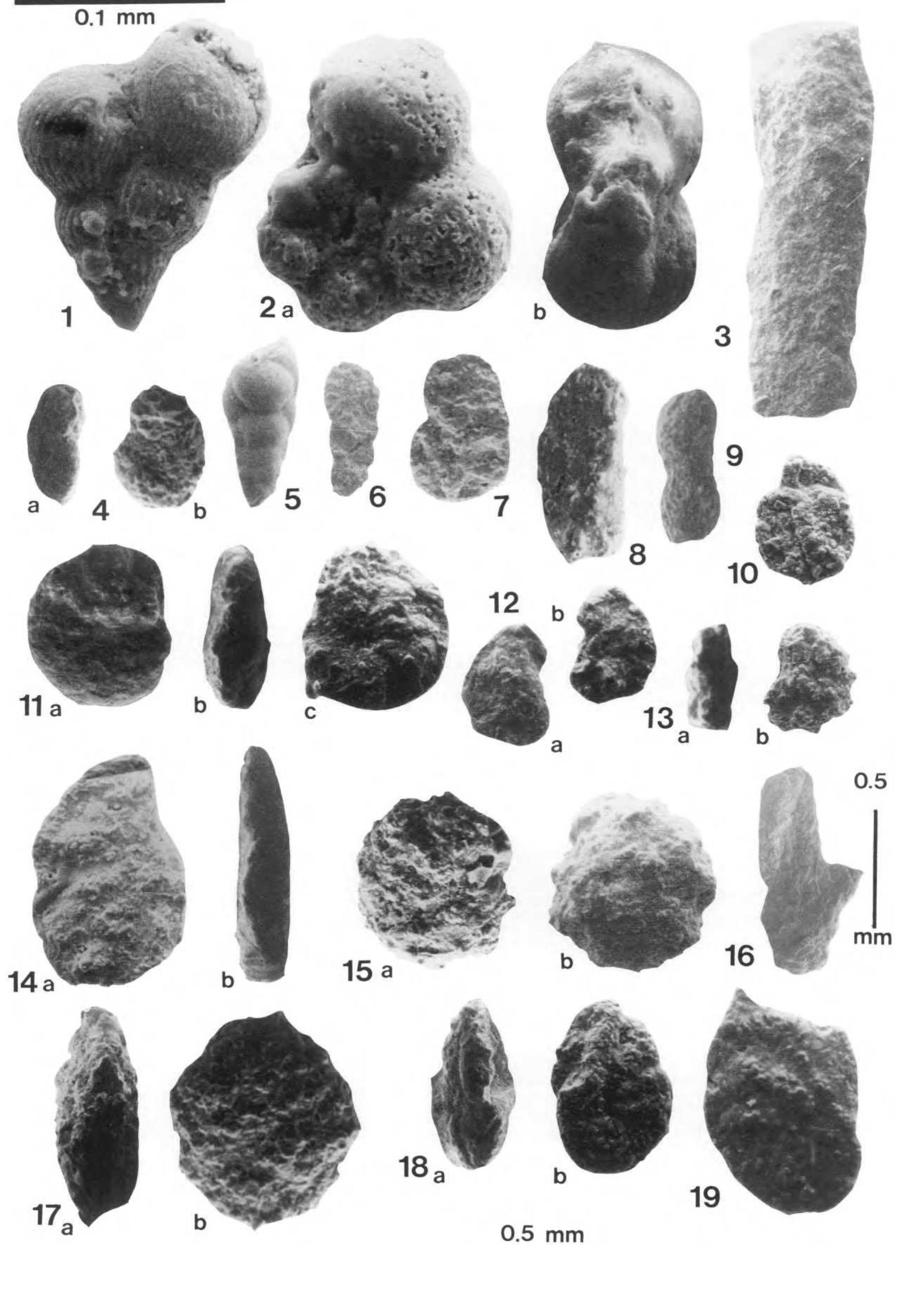 Figure 7 - Agglutinated foraminifera and sequence
