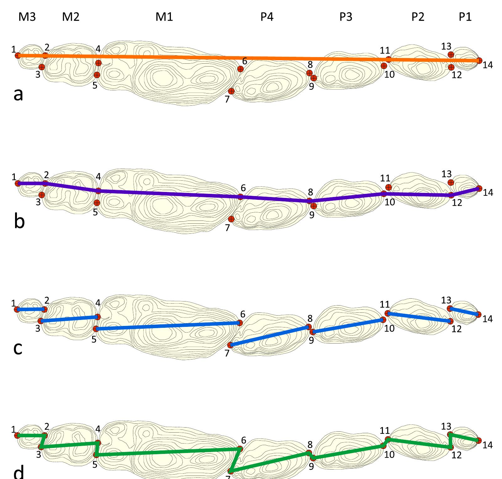 Diagrams of the mandibular toothrow with the location of the