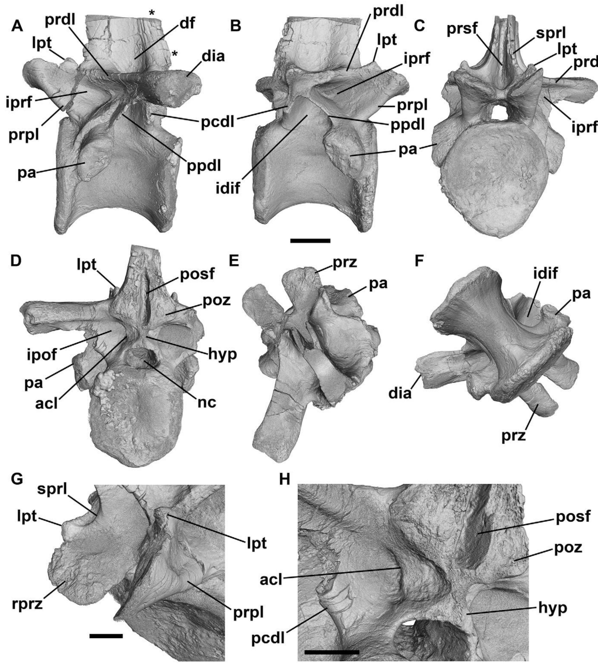 External morphology of nhm r16586, anterior dorsal vertebra,