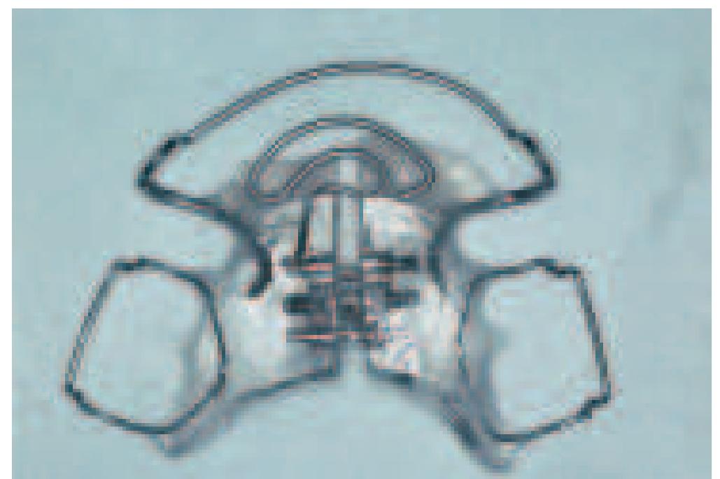 Fic. 1 expansion and labial segment alignment appliance.
