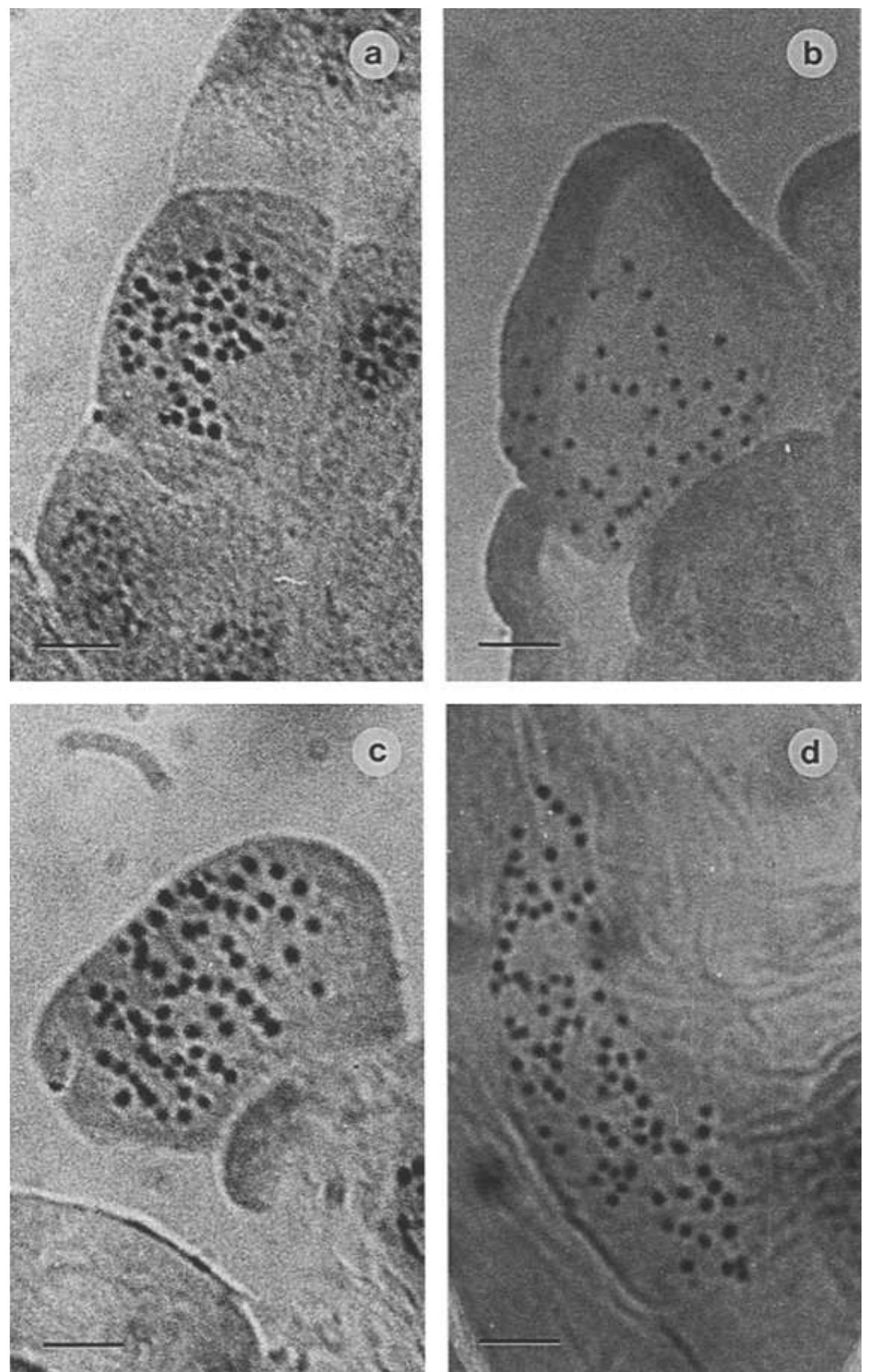 Photomicrographs of mitotic metaphase karyotypes of azolla.
