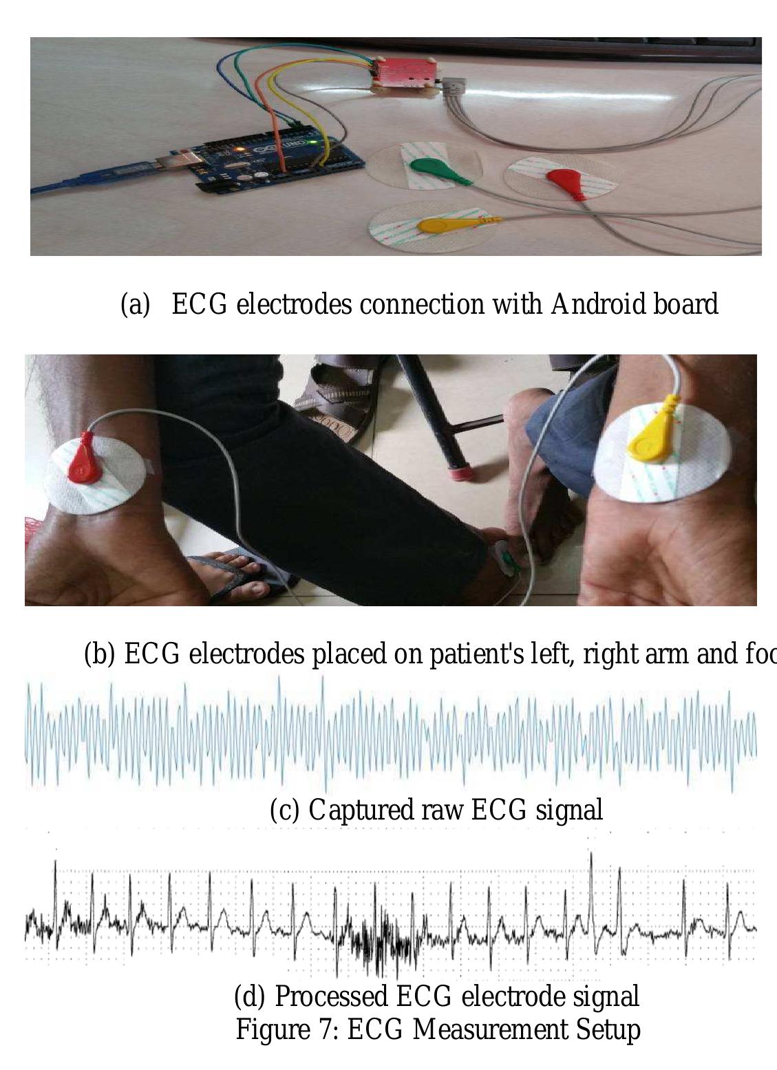 Pulse oximetry sensor circuit connection and signal response