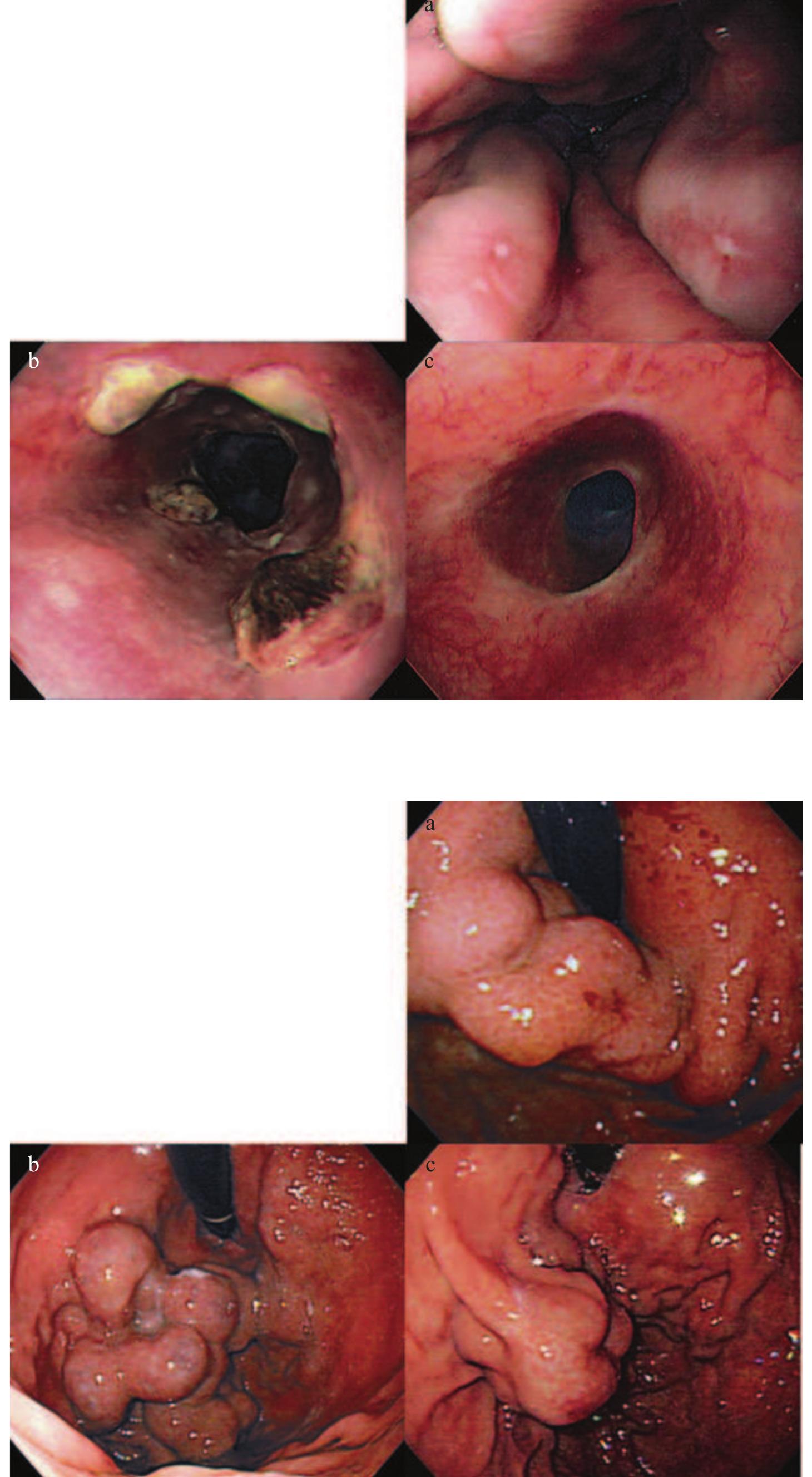 Figure 6 - General Rules for Recording Endoscopic Findings