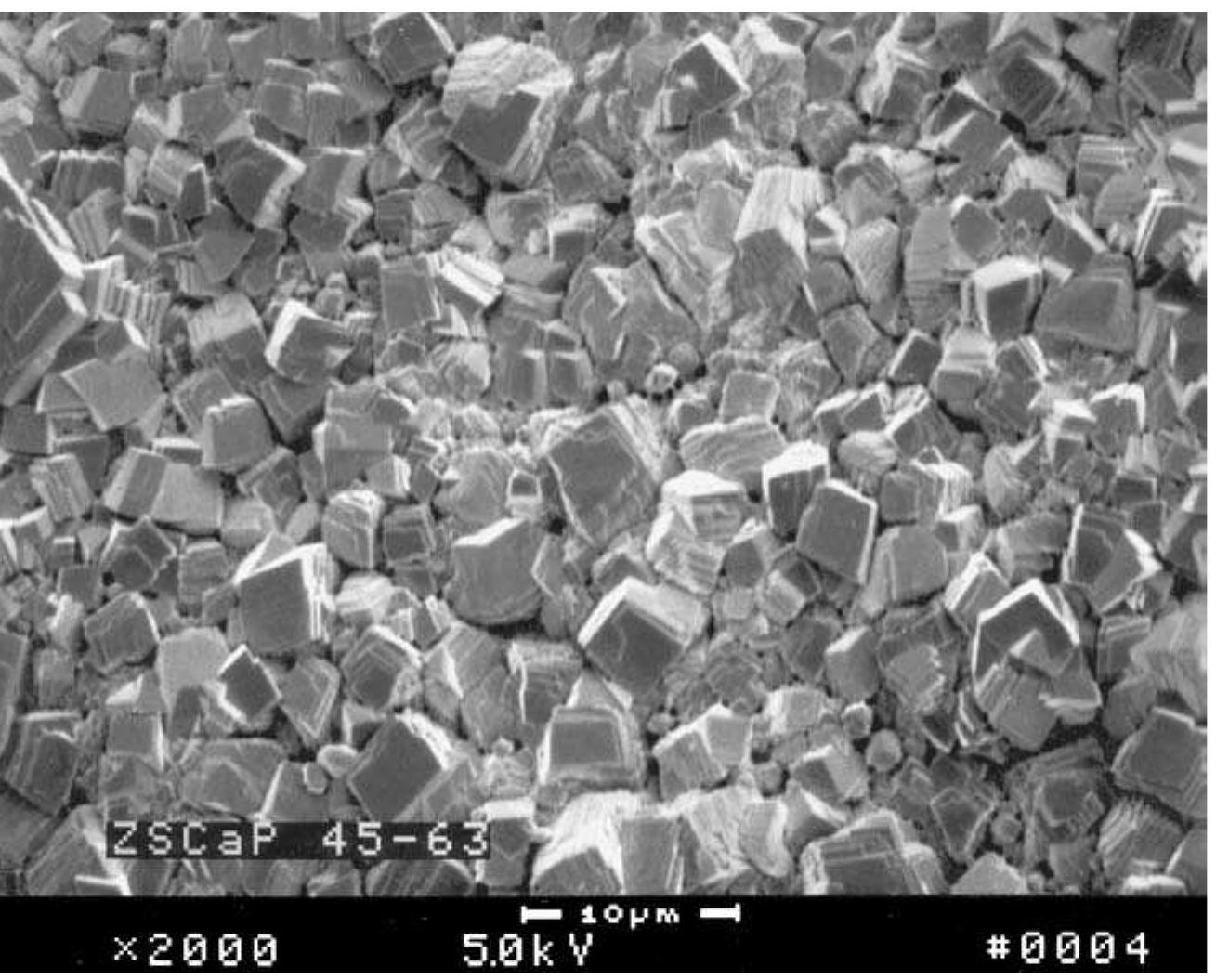 11 Scanning Electron Micrograph 2000x Of A Set And