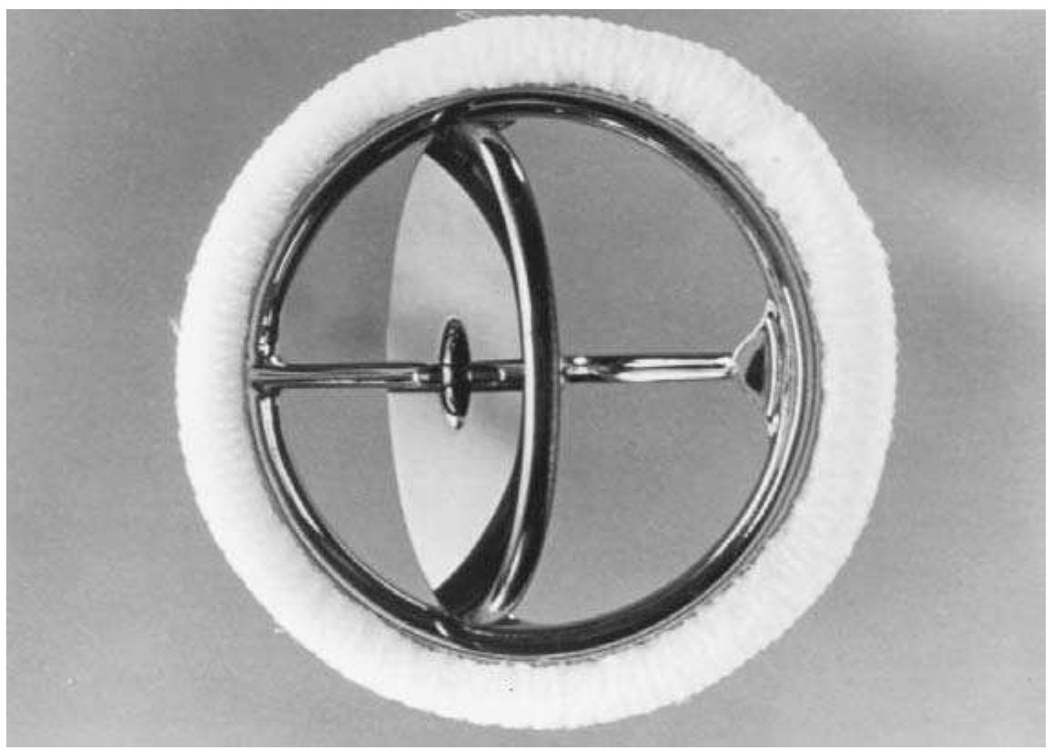 2a photograph of a typical tilting disc valve prosthesis.