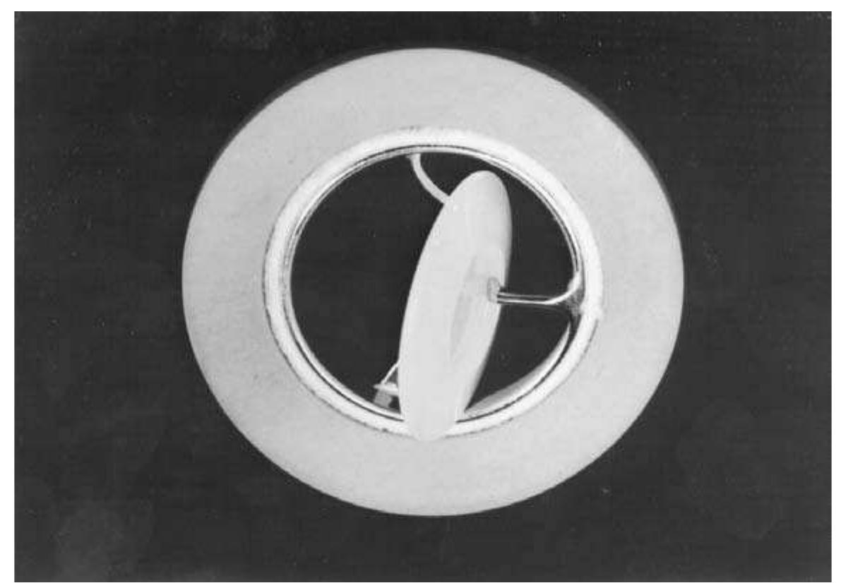 2b chitra tilting disc valve prosthesis with the occluder