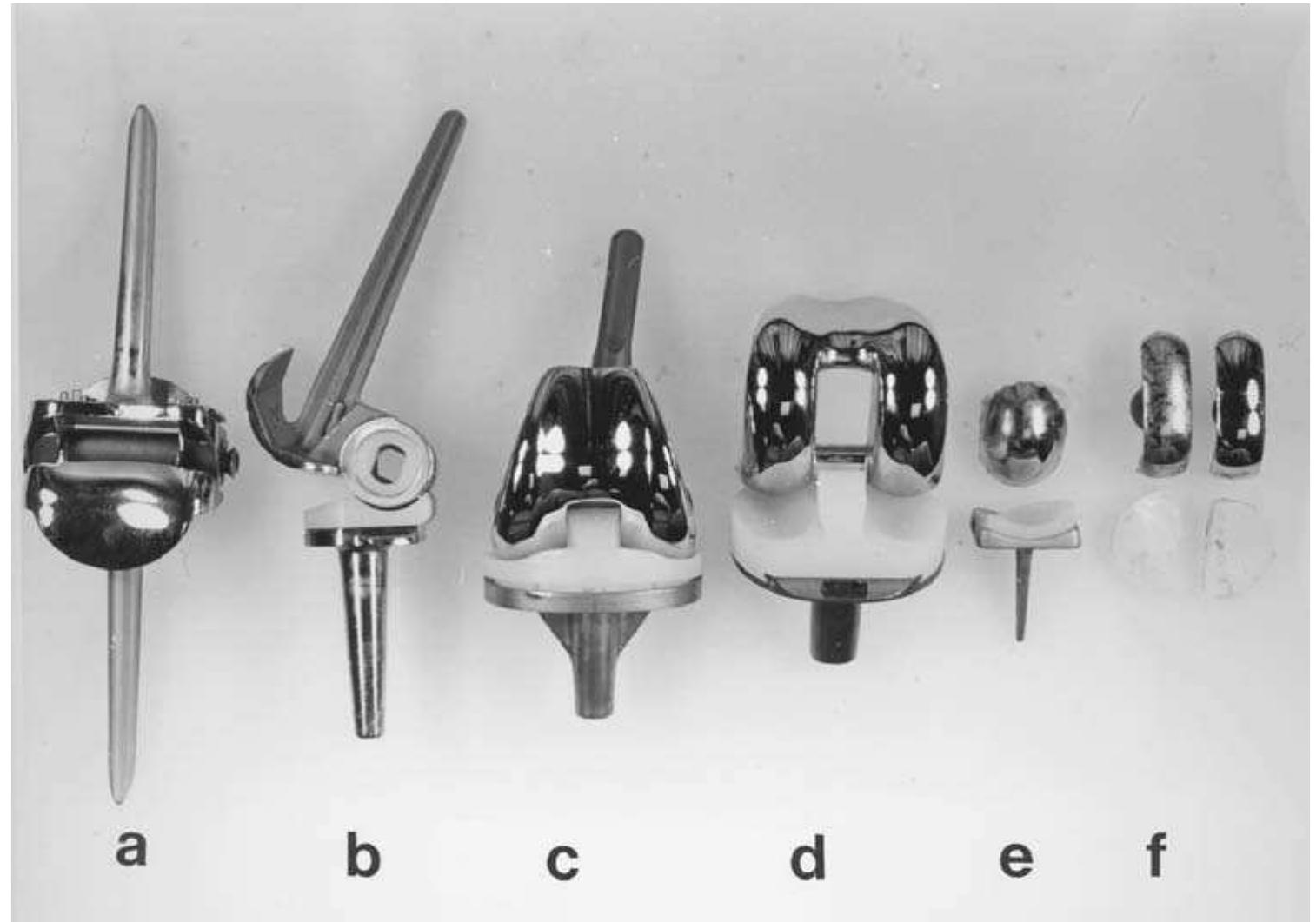 9 various types of knee joints: (a) metal hinged, (b) hinged