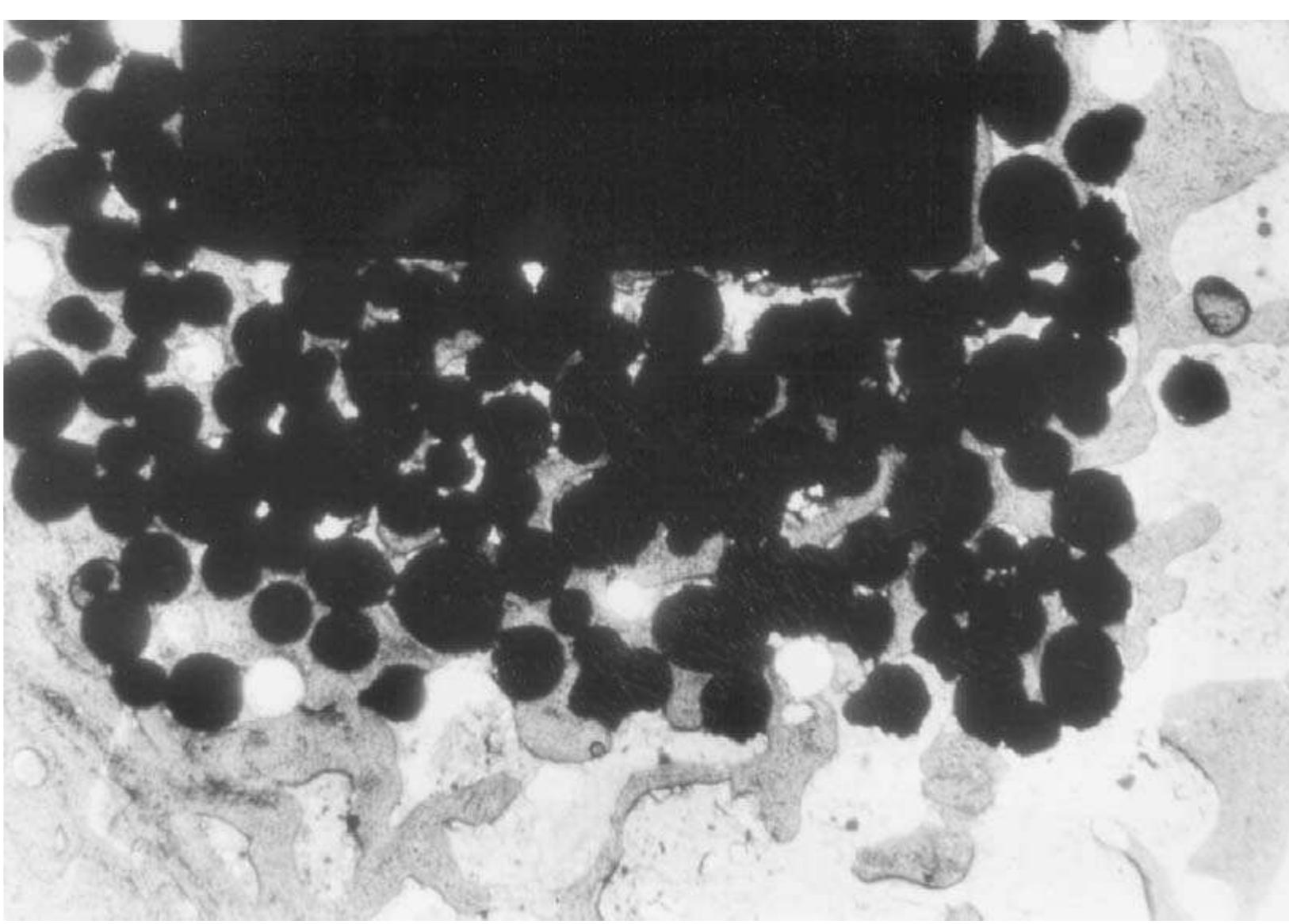 17 light microscopic photomicrograph of a bone—porous ti