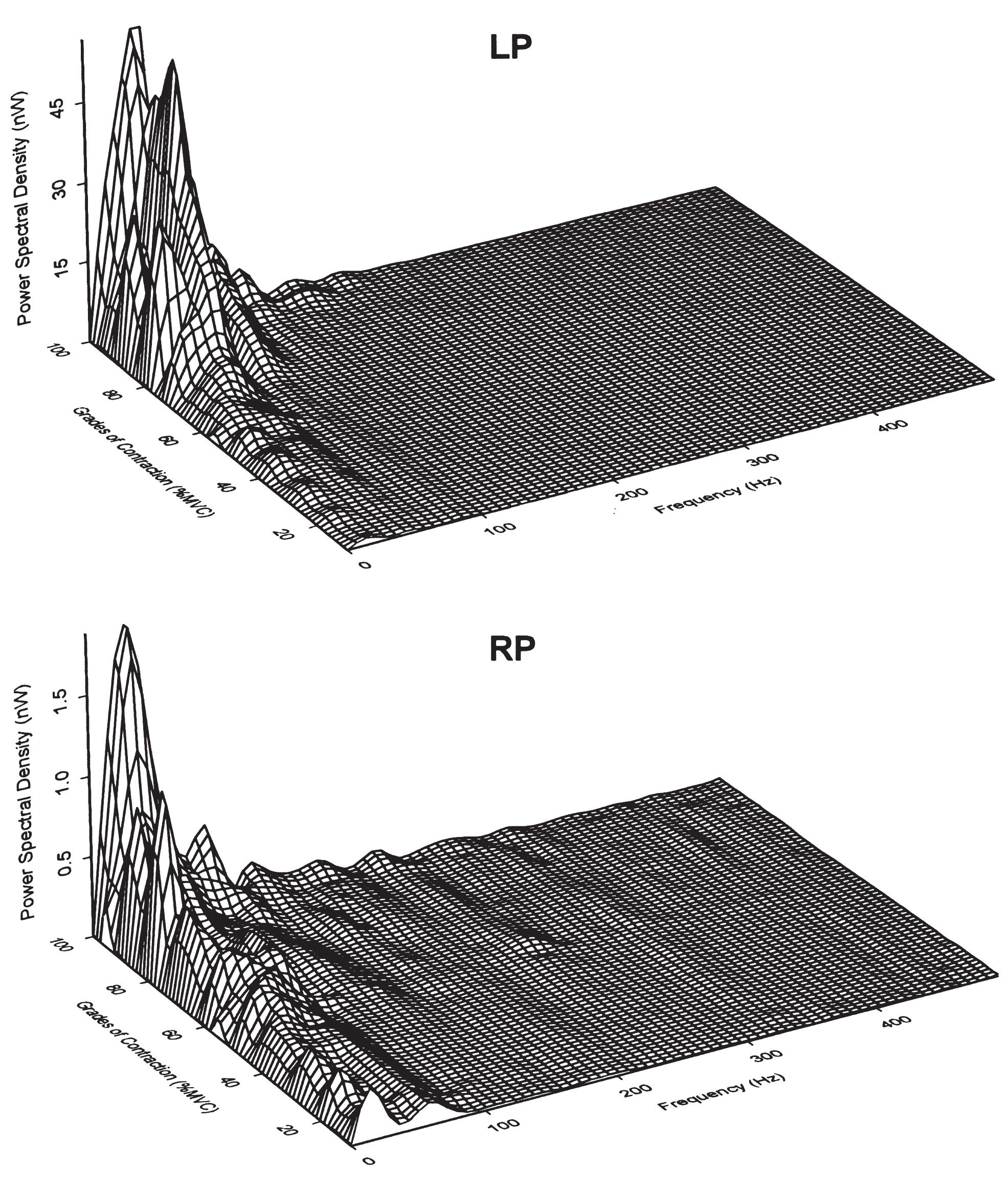 Power spectra of left and right latissimus dorsi in a