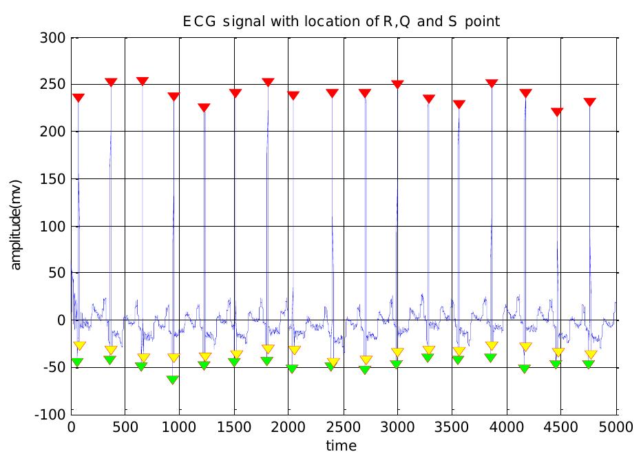 -10 fft spectrum of filtered and unfiltered ecg signal with