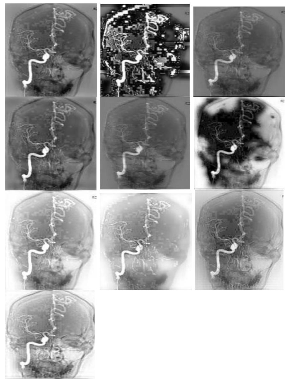 (a) laplacian pyramid; (b) ratio of low pass pyramid fusion;