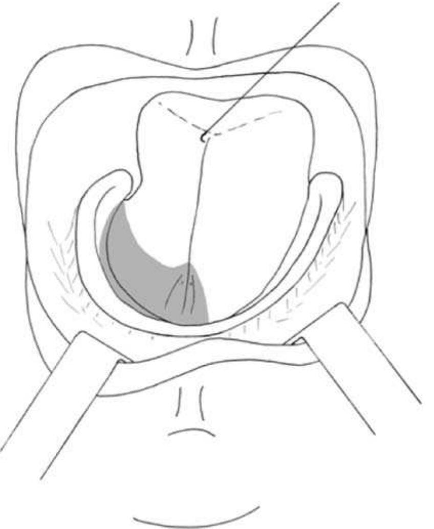 The vascular territory of the sublingual artery the mouth