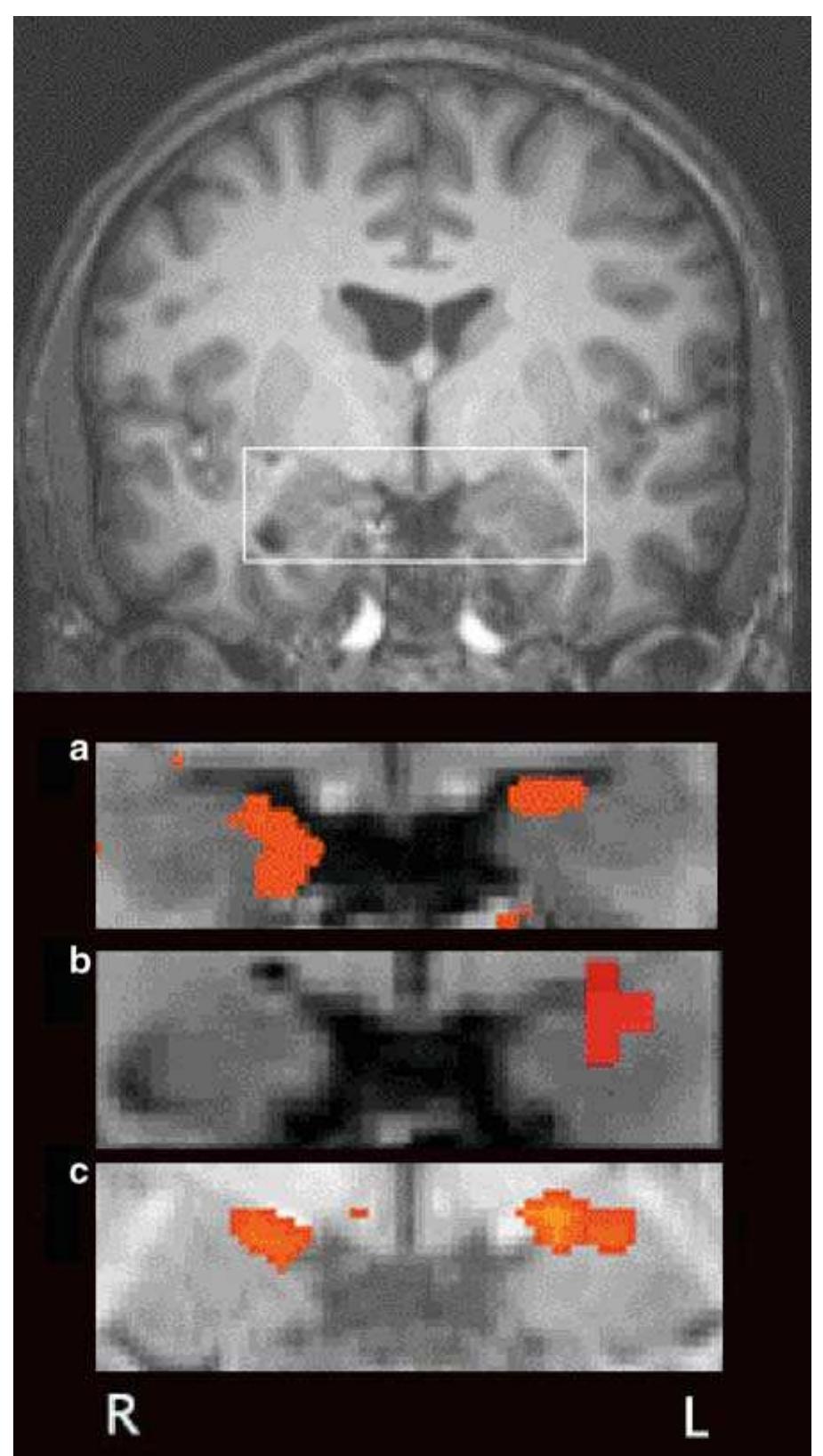 (PDF) The Amygdala and the Neural Pathways of Fear