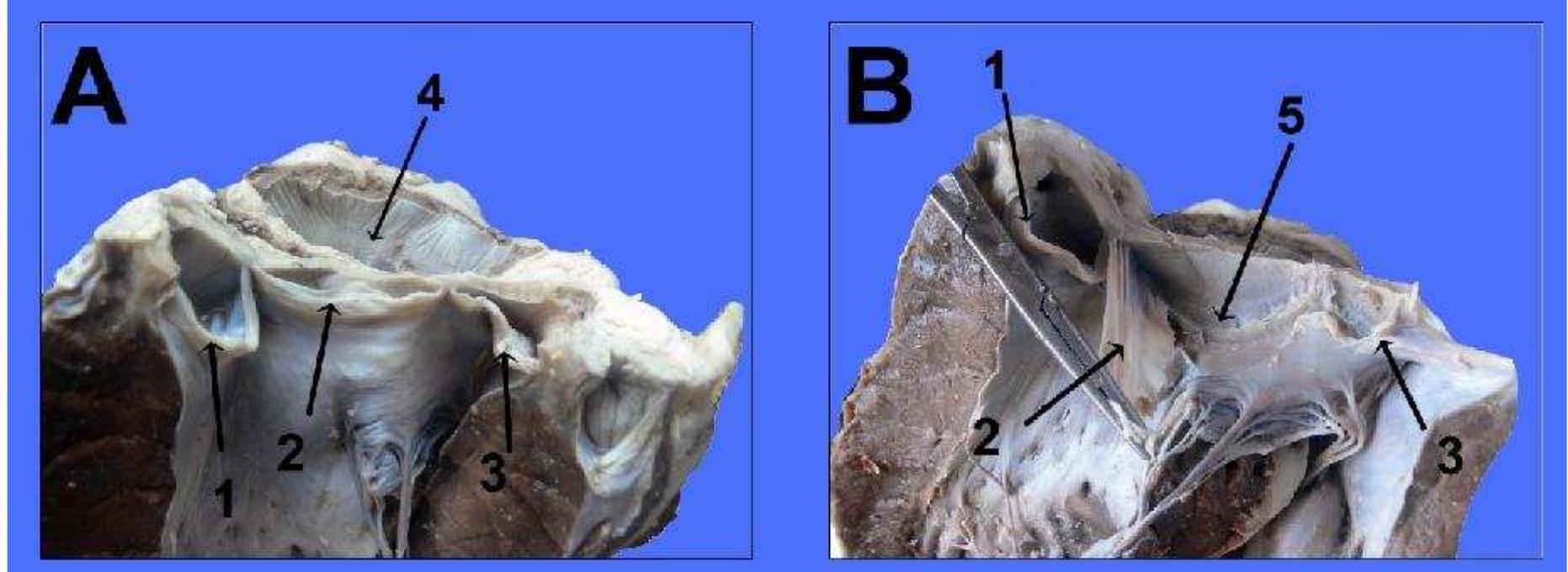 The aortic orifice (ostium aortae) is located at the center