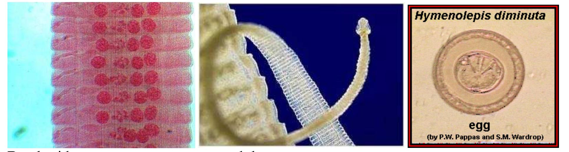 Figure 1 - from HYMENOLEPIS SPECIES HYMENOLEPIS DIMINUTA