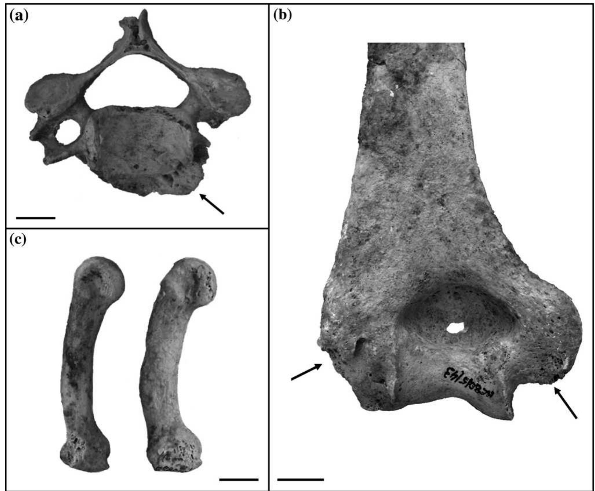 View of the /eft humerus distal extremity showing medial and
