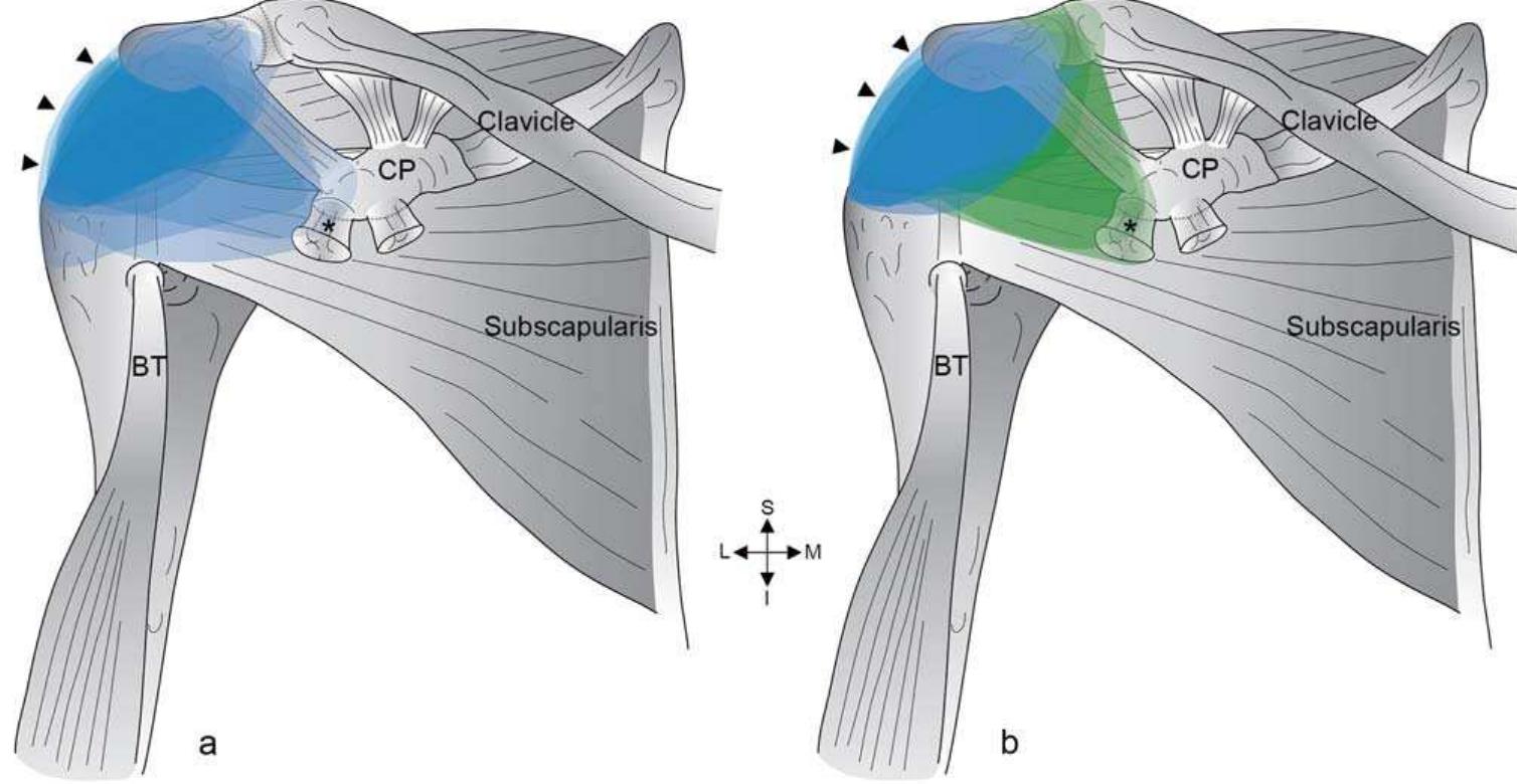 Indicate interface with deltoid/subdeltoid fascia; asterisk