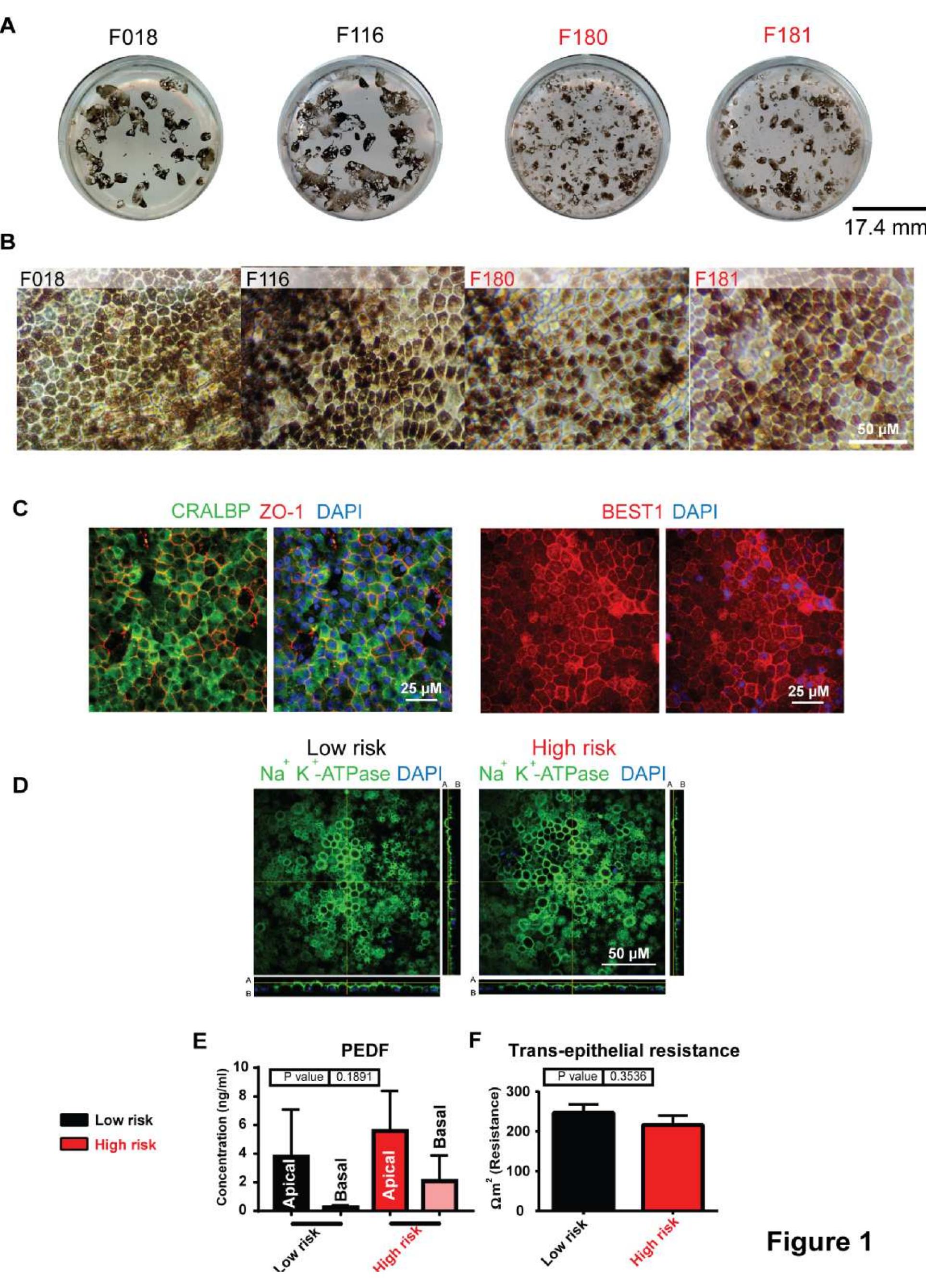 Derivation of amd-ipsc rpe. (a) light microscopy images of