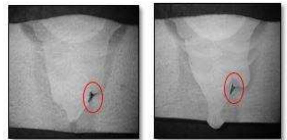 -5: radiograph of weld defect specimens the radiographs
