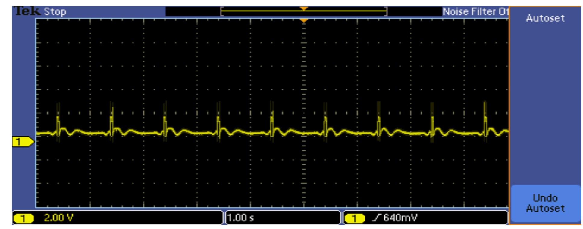 Plotted ecg signal on oscilloscope the implemented