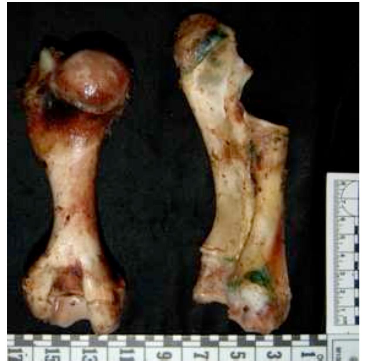 (figure 102) proximal and distal ends of left radius and