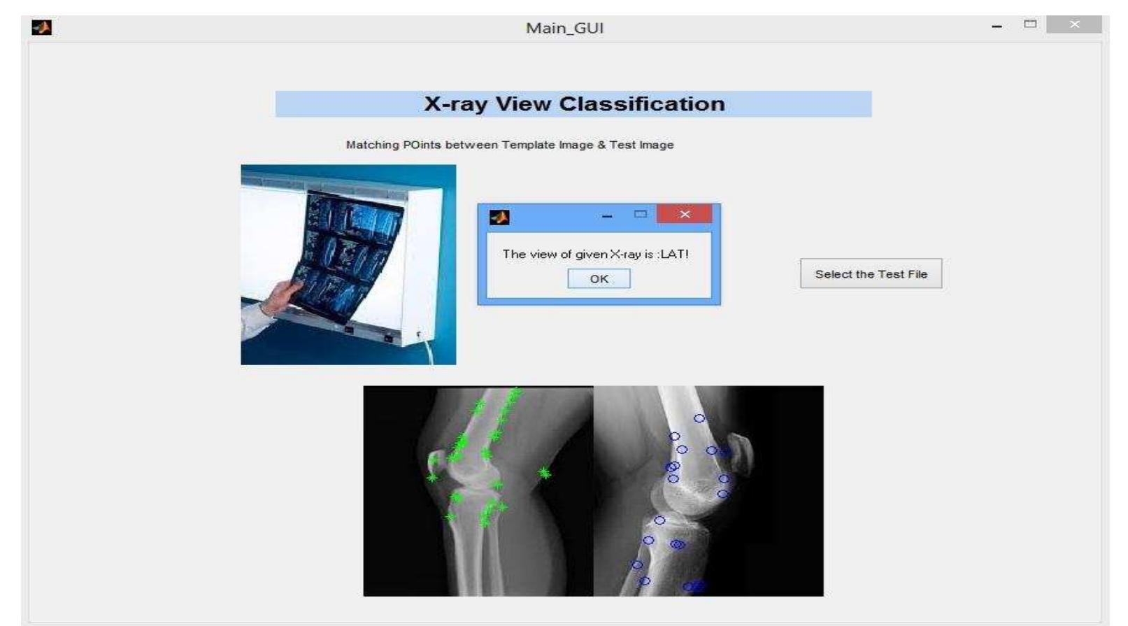 Snapshot of x- ray view classification system fig. 4 block