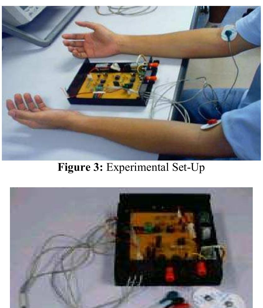 In the experiment conducted, the ecg was taken using a lead