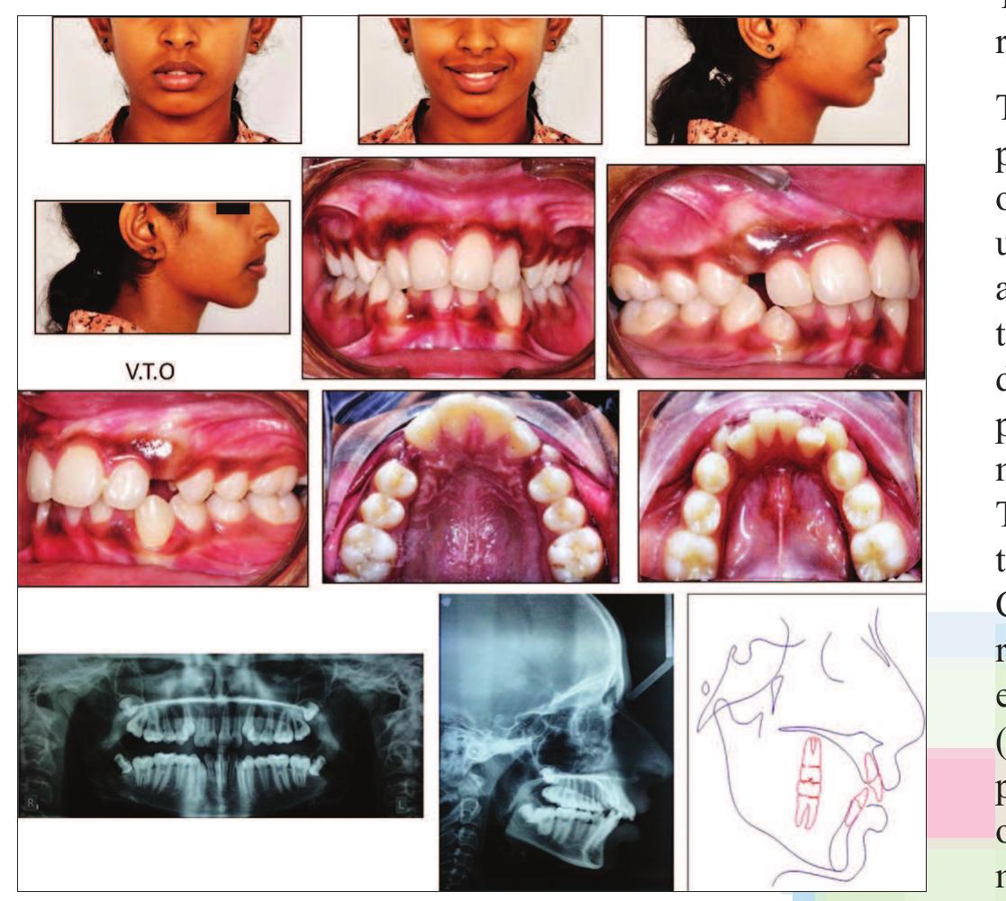 Pretreatment photographs and radiographs by | mm with