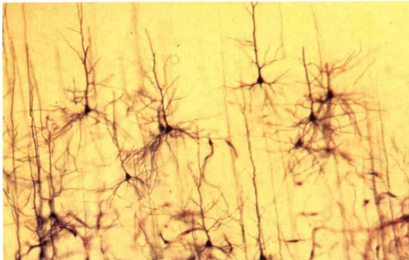 Neurons, revealed by golgi staining, carry nerve impulses.