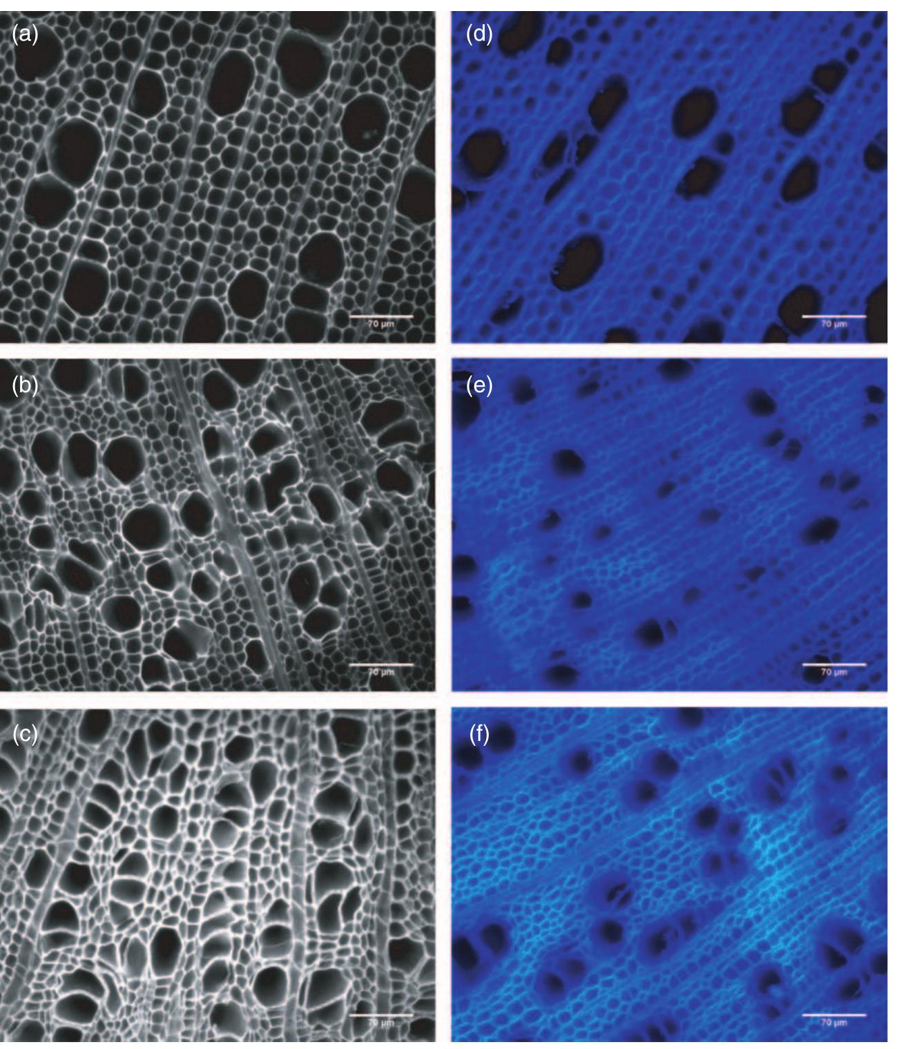 Vessel count and quantification of cross-sections of 5-