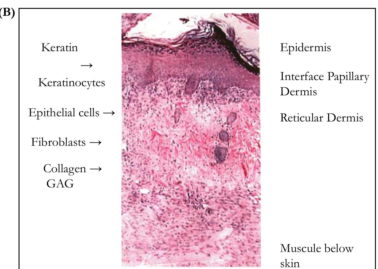 B. the cross section of normal skin demonstrates the key