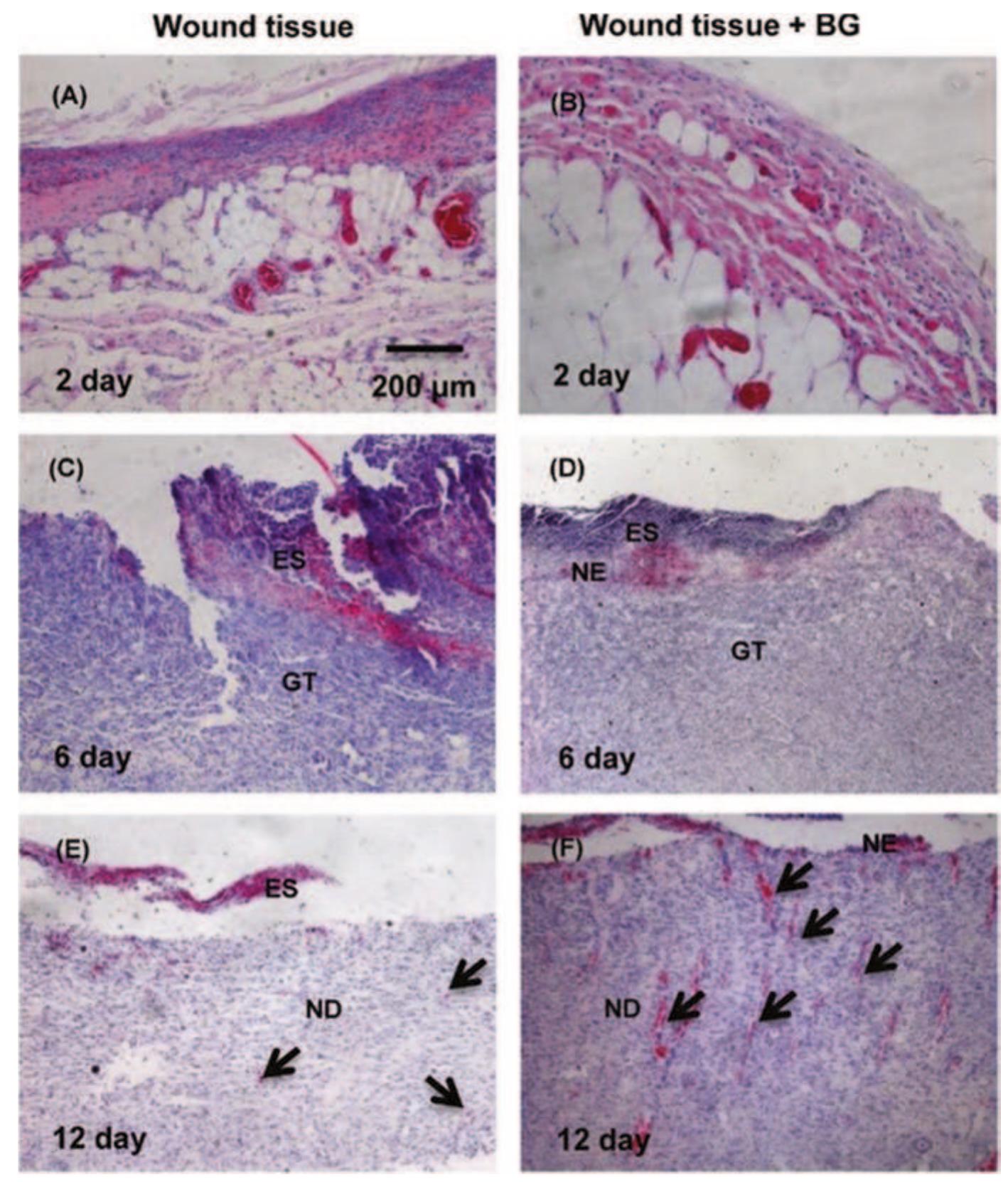 Figure 23 - from Clinical Applications of Biomaterials
