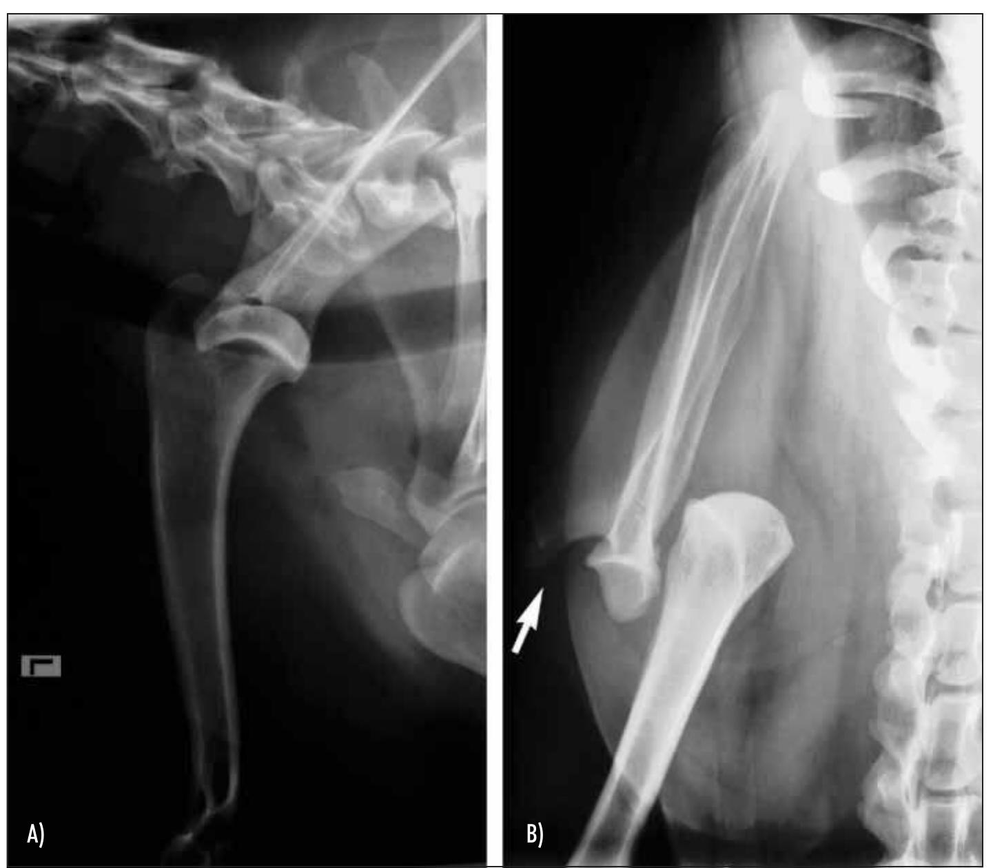A) radiographs of the left shoulder showing superimposition