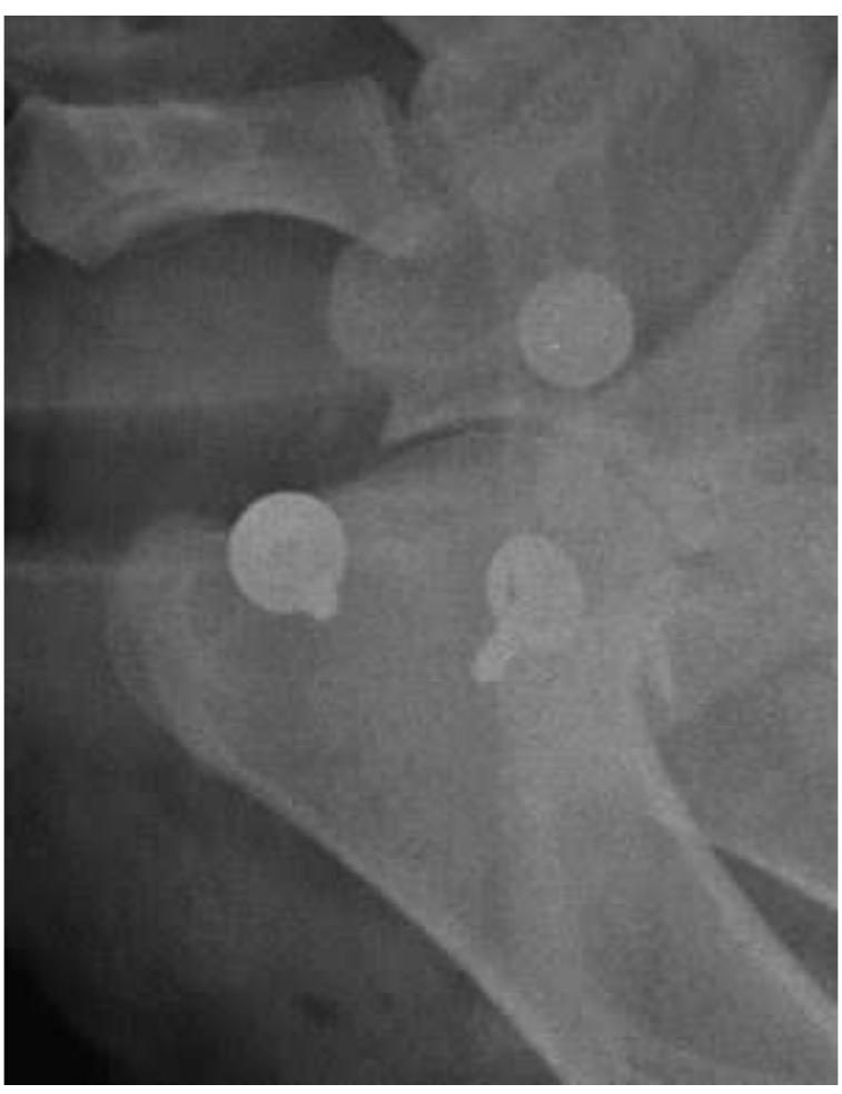 Alpaca 2, radiograph of left shoulder, 15 years after