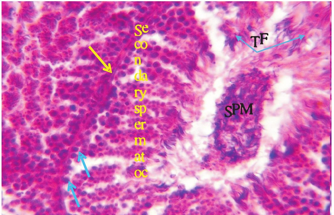 Plate 4: photomicrograph of chicken testis (low energy high