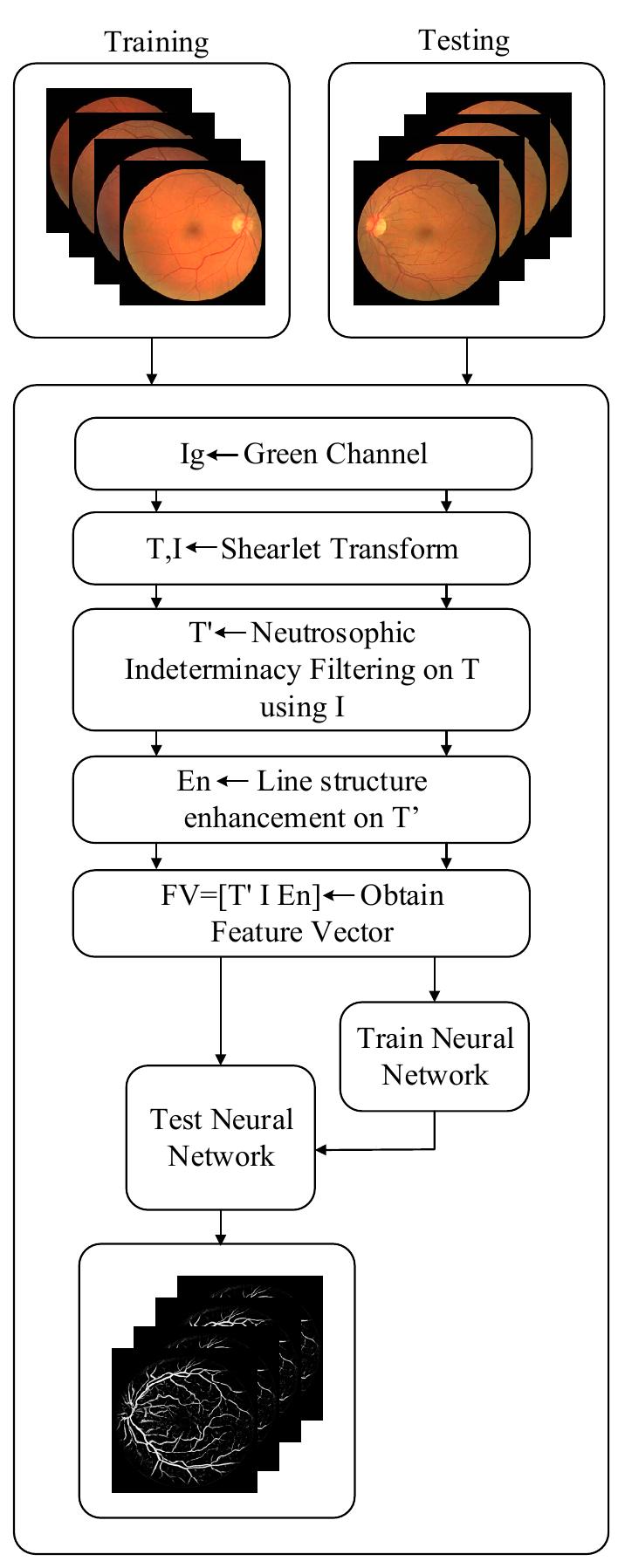 Flowchart for retinal vessel detection. 3. experimental