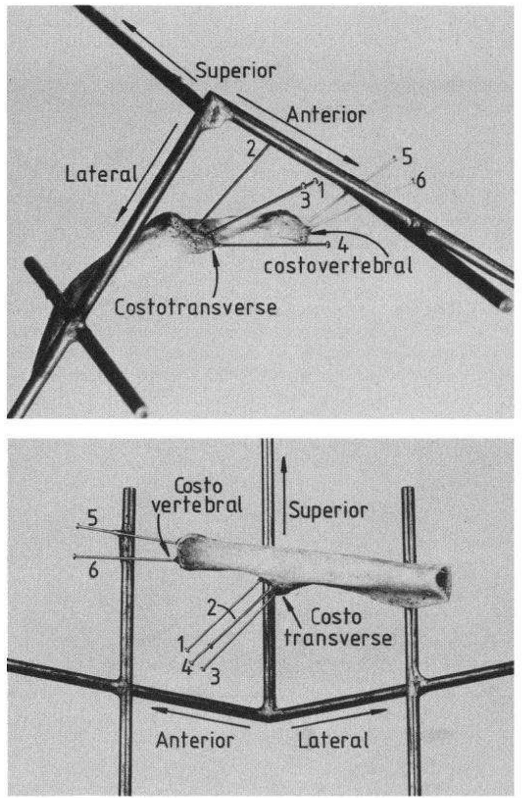 Two photographs across costotransverse joint surface of 4th