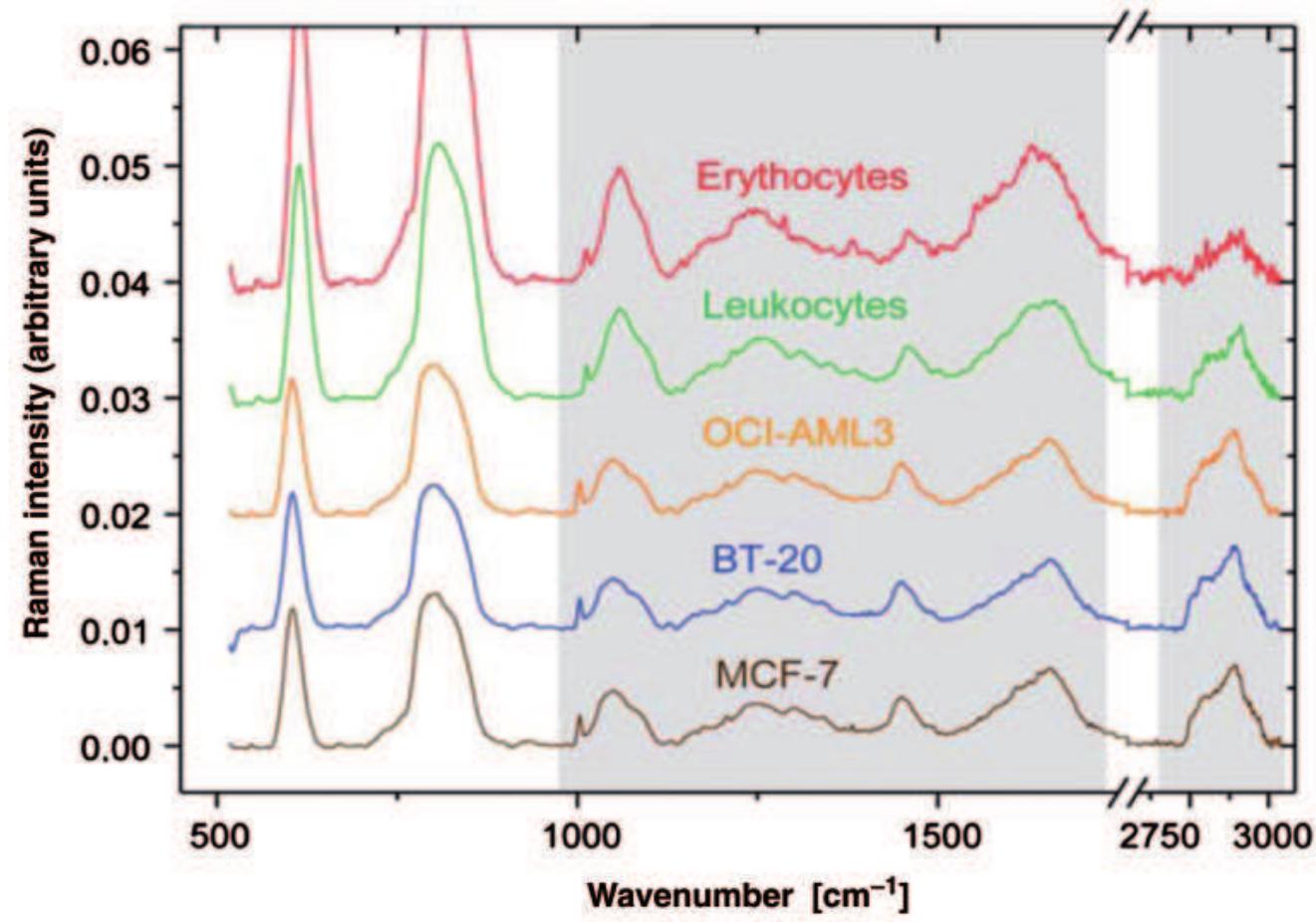 Mean raman spectra of wbcs compared to various leukemia