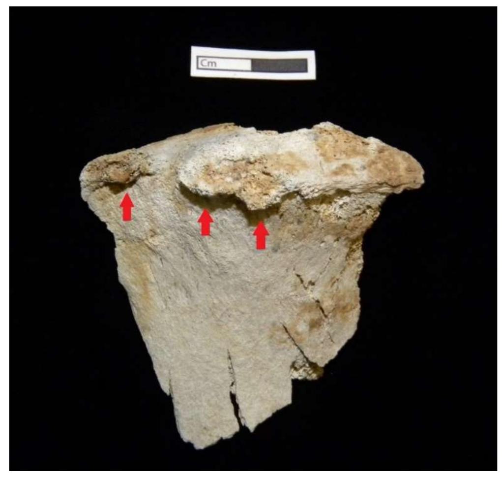 Right iliac crest fragment, posterior view: enthesophytes