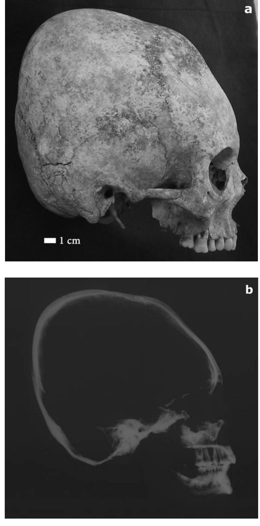 Modified skull 09.01: (a) right lateral view of the cranium