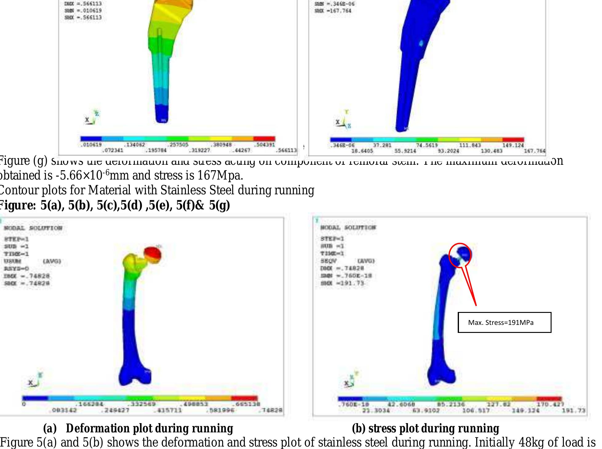 Figure 8 - DESIGN & FEM ANALYSIS OF HIP IMPLANT FOR WALKING