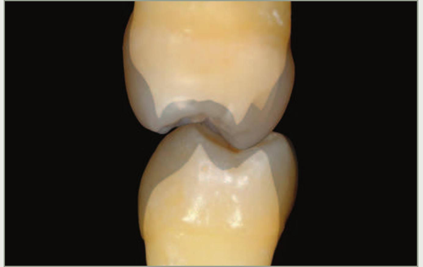 A thorough understanding of the histo- anatomic structures