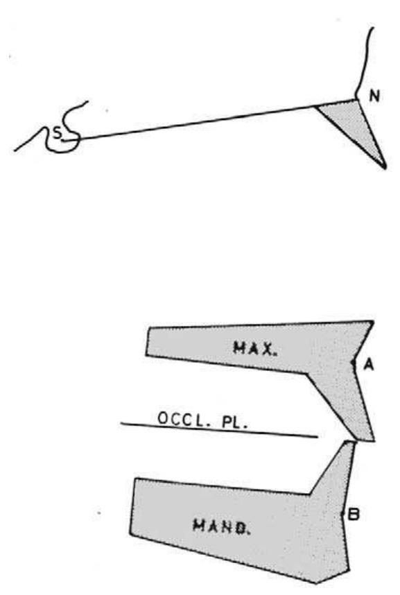 (PDF) The " Wits " appraisal of jaw disharmony