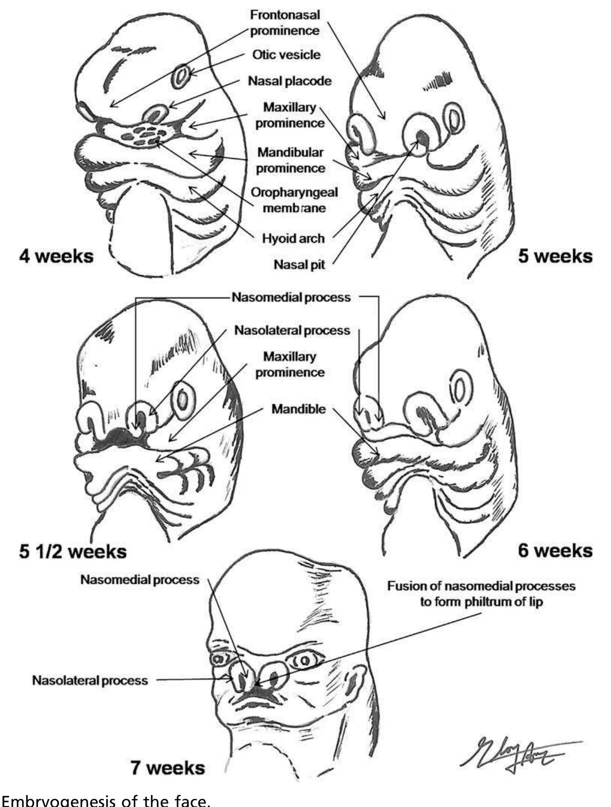 Figure 1 - Nasal, Septal, and Turbinate Anatomy and Embr
