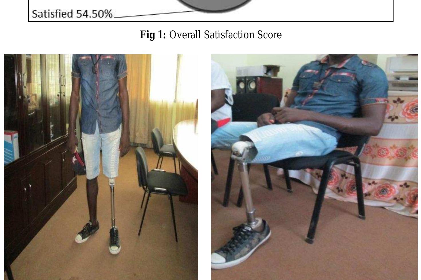 Patient wearing a temporary left articulated femoral