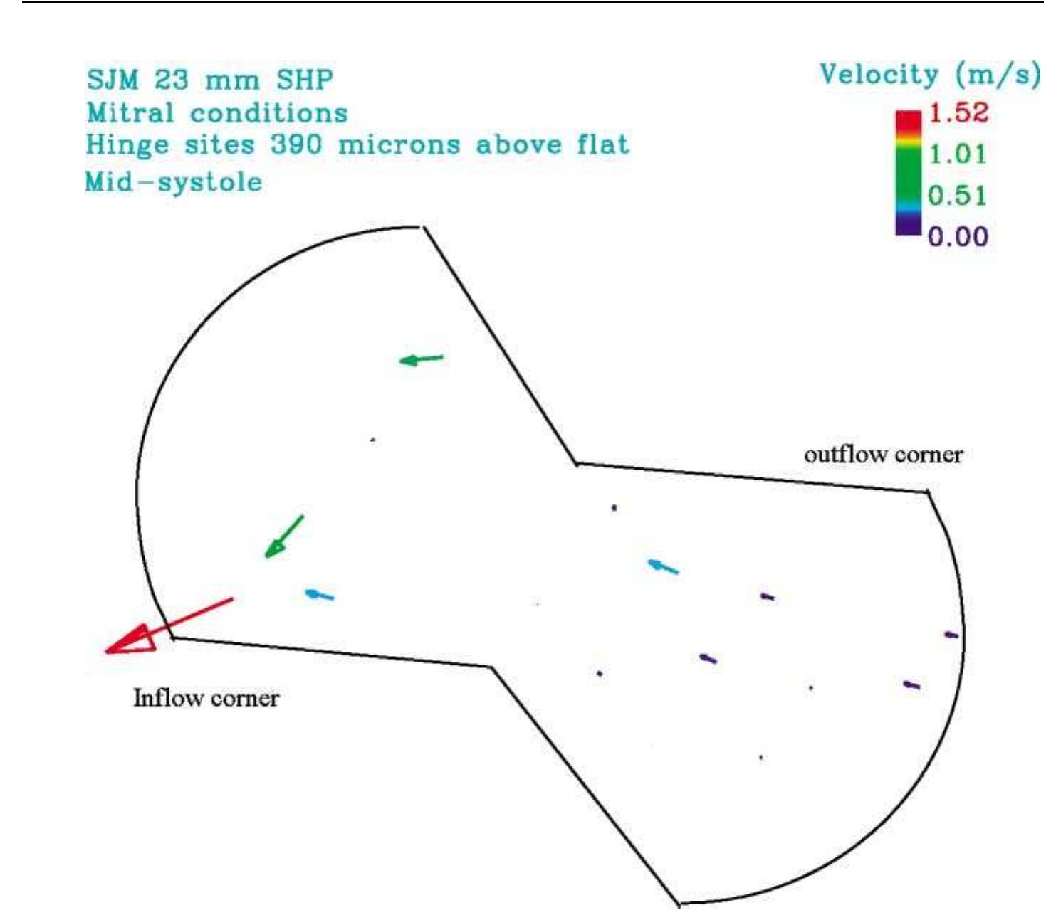 St. jude medical regent mitral valve (23 mm) hinge flow